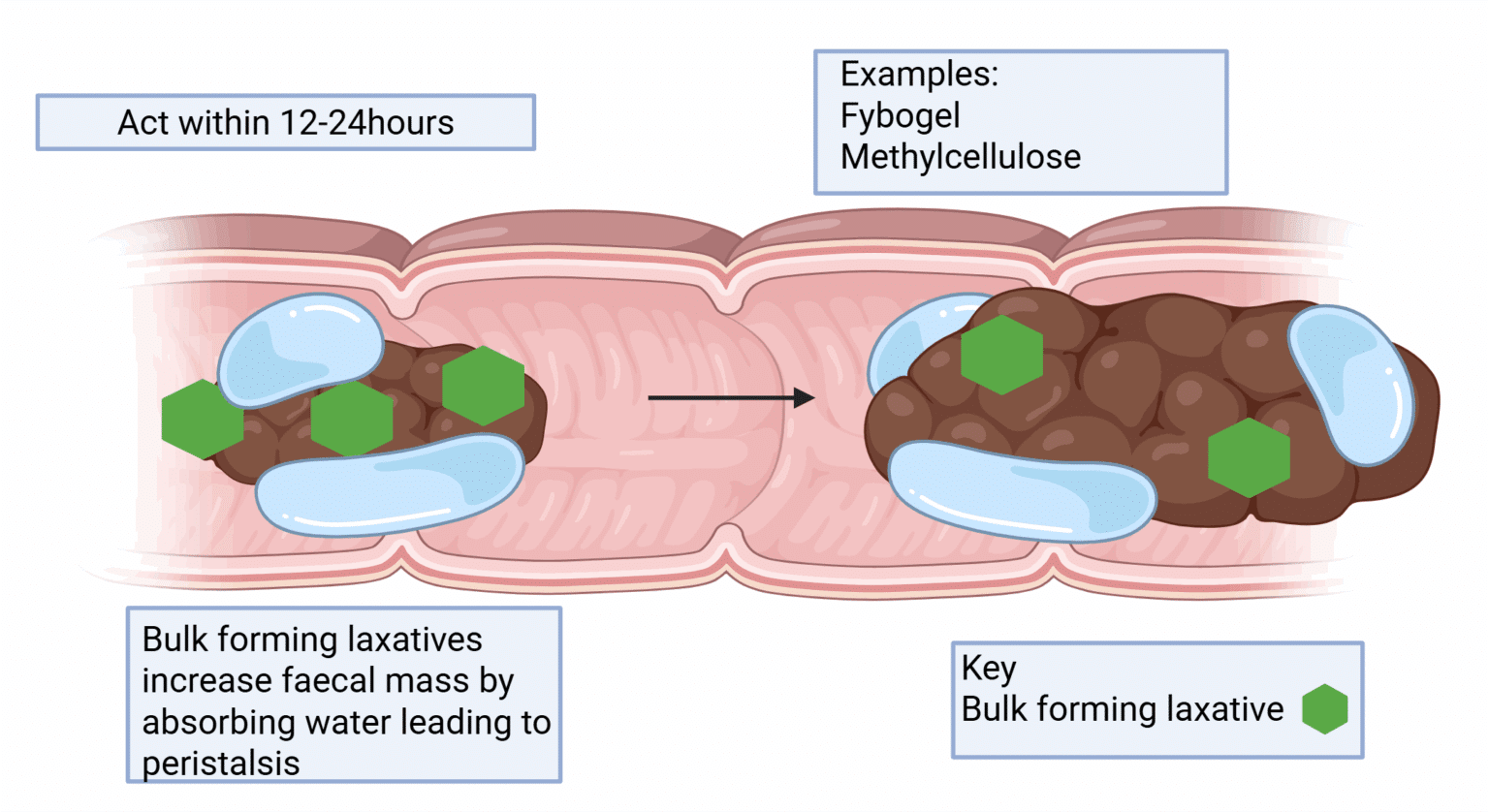 Laxatives Made Simple: Classes, Mechanisms, and Clinical Use for ...