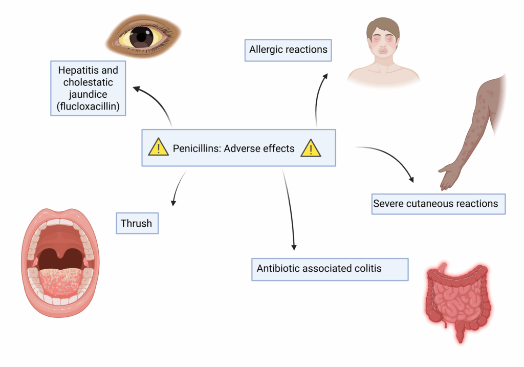 Penicillin Antibiotics: Contraindications, Adverse Effects ...