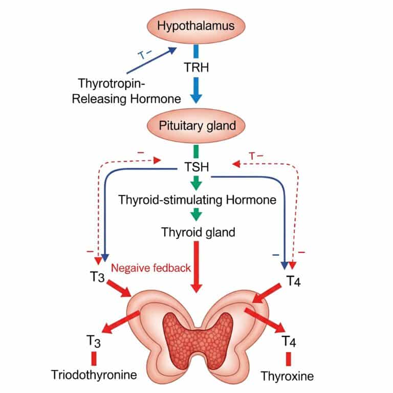 Hypothyroidism: Causes, Classification, Treatment and Thyroid Hormone ...